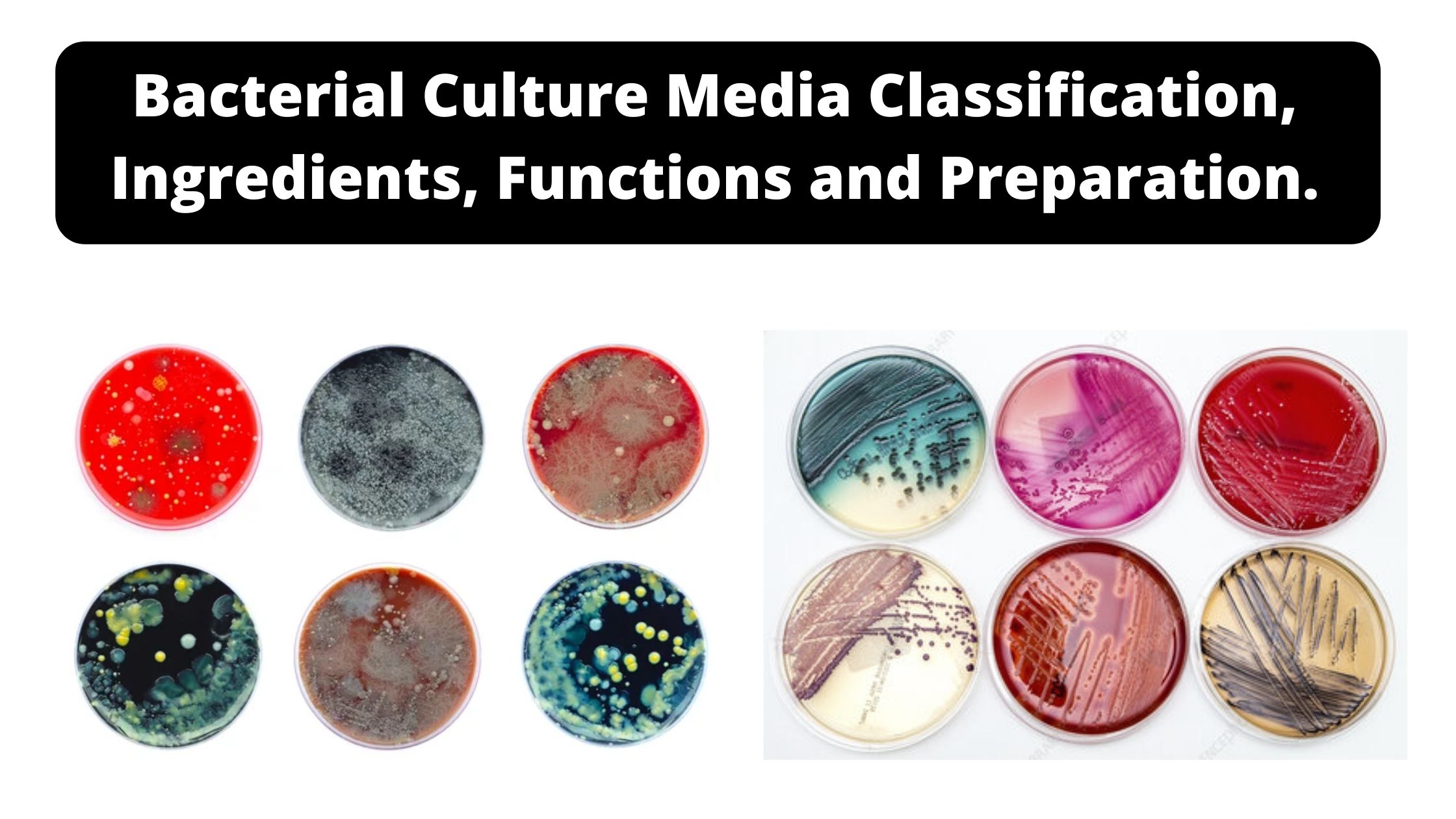 What are the 3 common ingredients of culture media that are used in the laboratory?