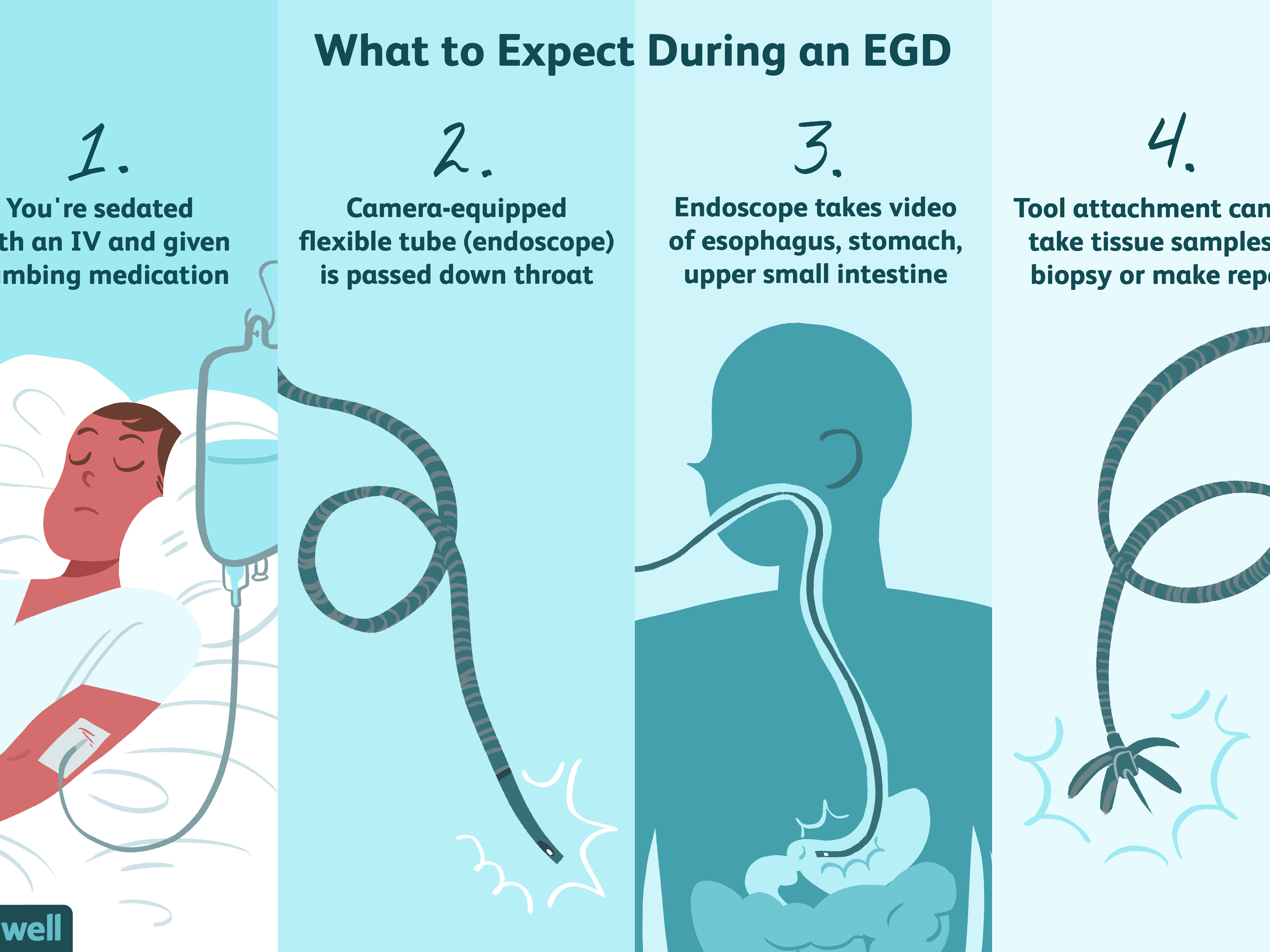 What are the after effects of an endoscopy?