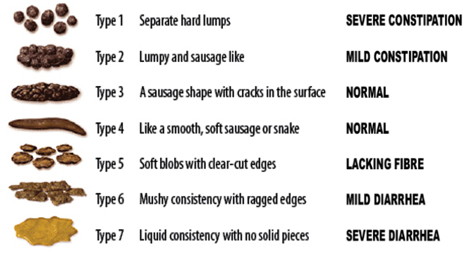 What are the different stages of constipation?