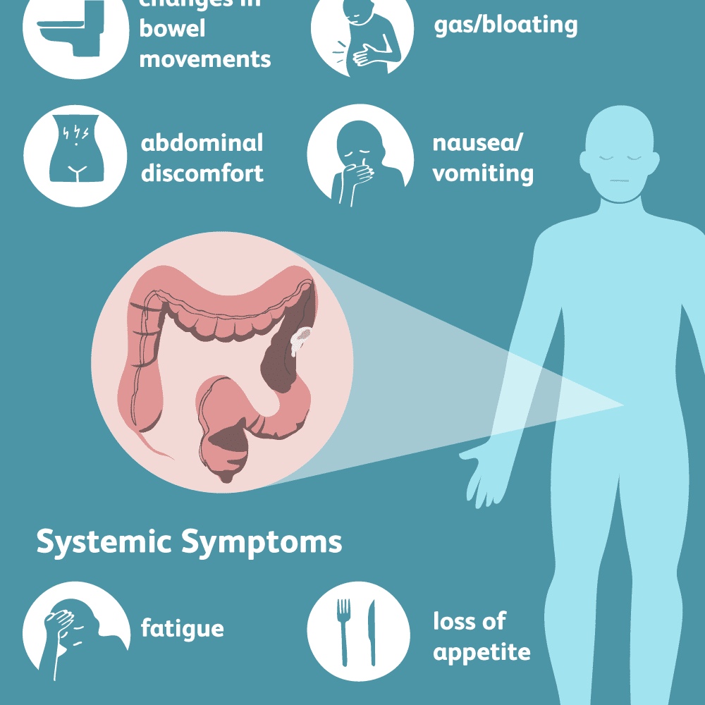 What are the first signs of having colon cancer?