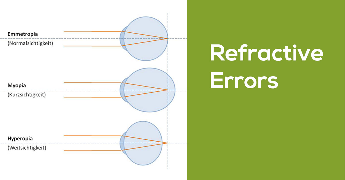 What are the four most common vision problems?