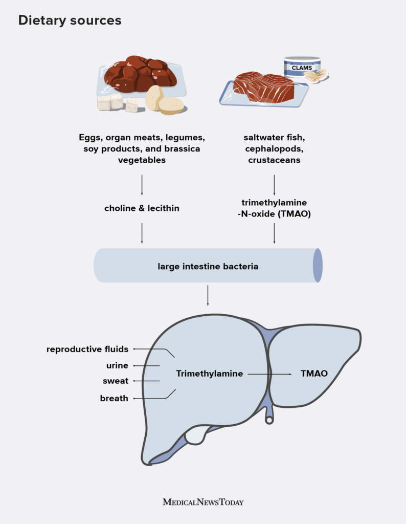 What are the signs and symptoms of trimethylaminuria?