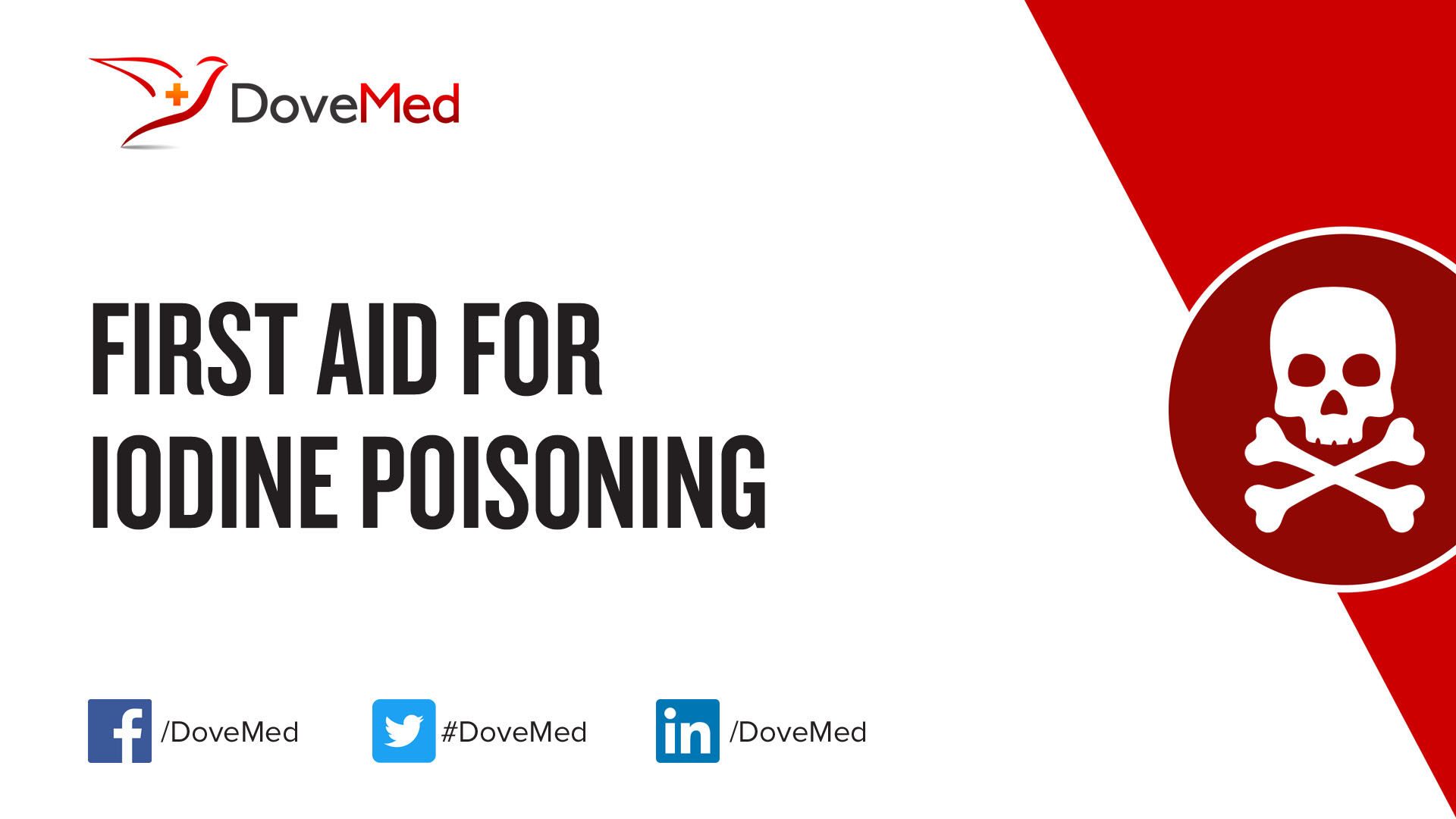 What are the signs of iodine poisoning?