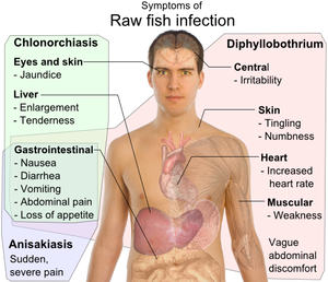 What are the symptoms of eating raw fish?