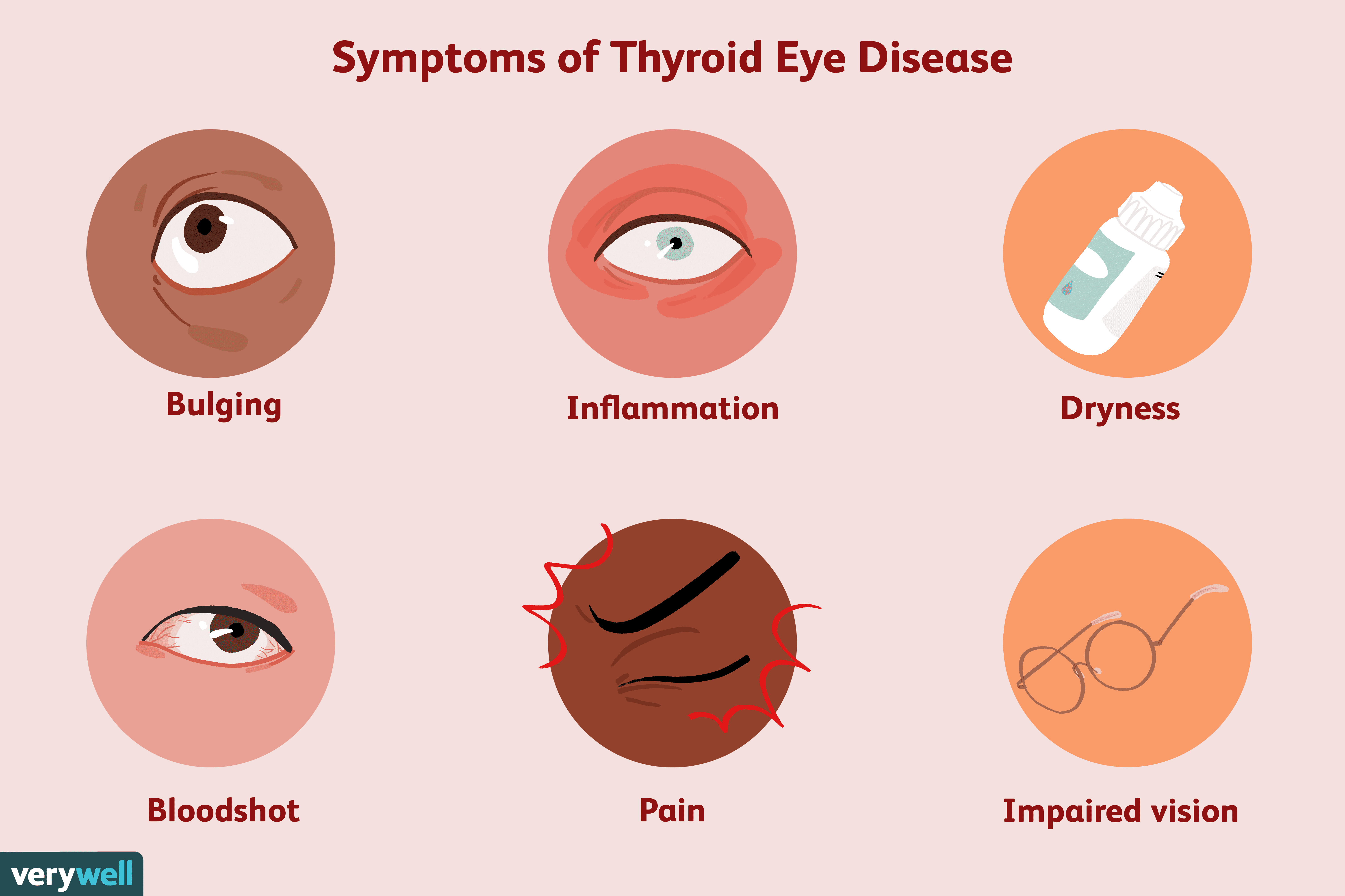 What are the symptoms of eye disease?
