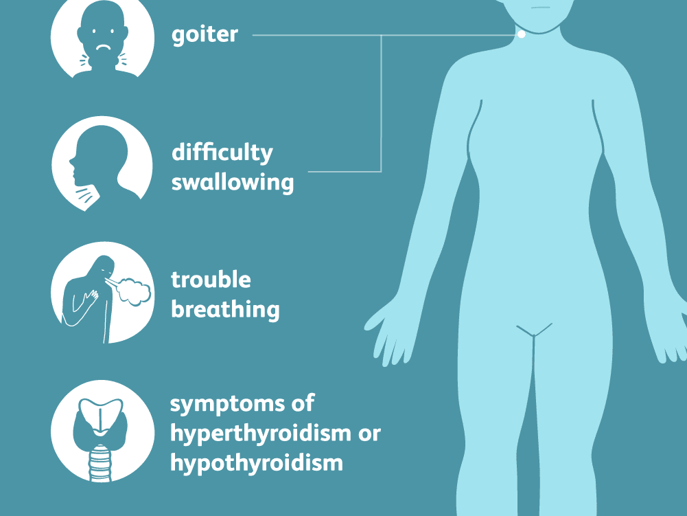 What are the symptoms of low iodine?