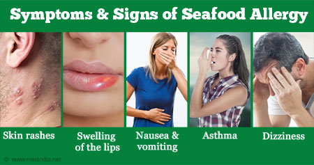 What are the symptoms of prawn allergy?