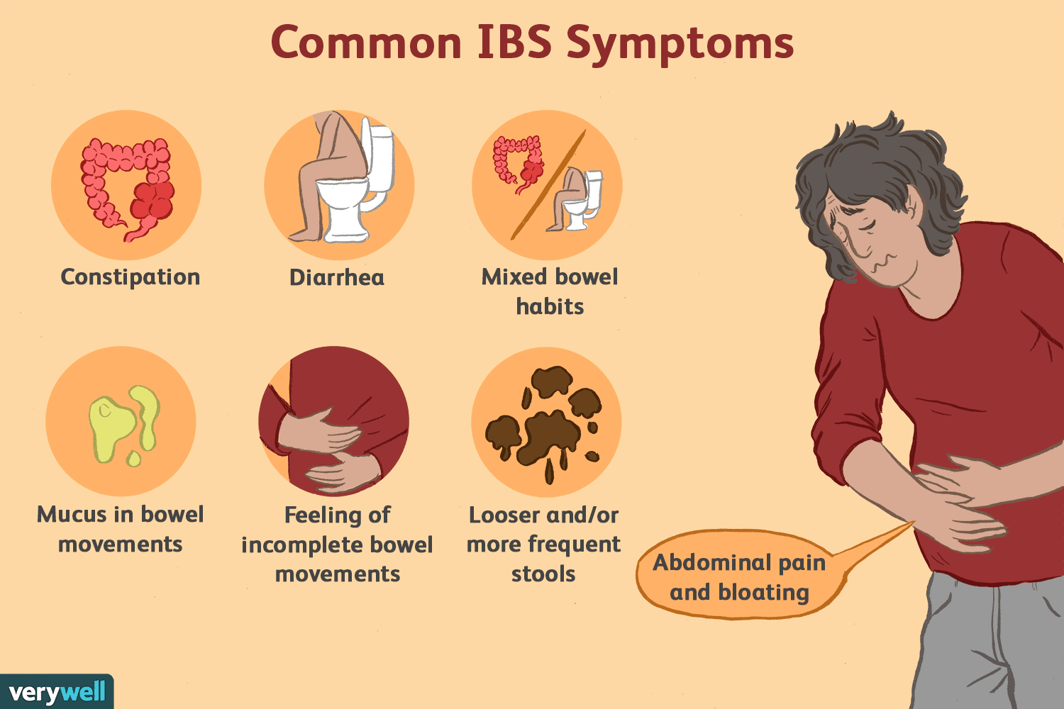 What are the symptoms of severe IBS?
