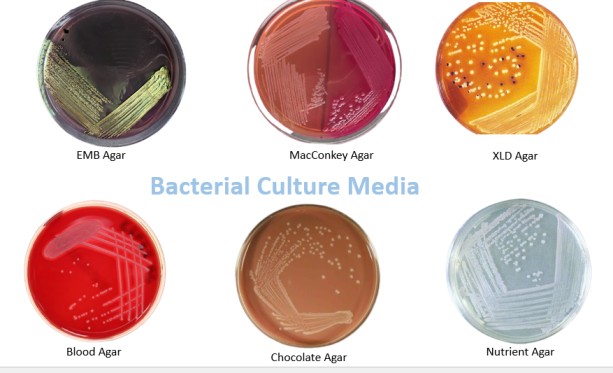 What are the three main types of microbiological culture media?