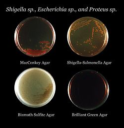 What are the three types of agar?