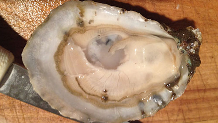 What bacteria can you get from shellfish?