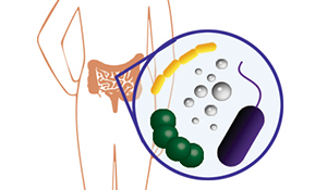 What bacteria causes gas?