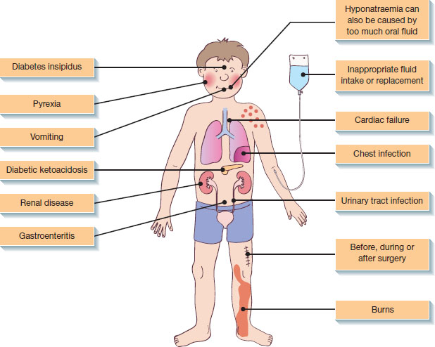 What can an imbalanced intake and output of fluid lead to?