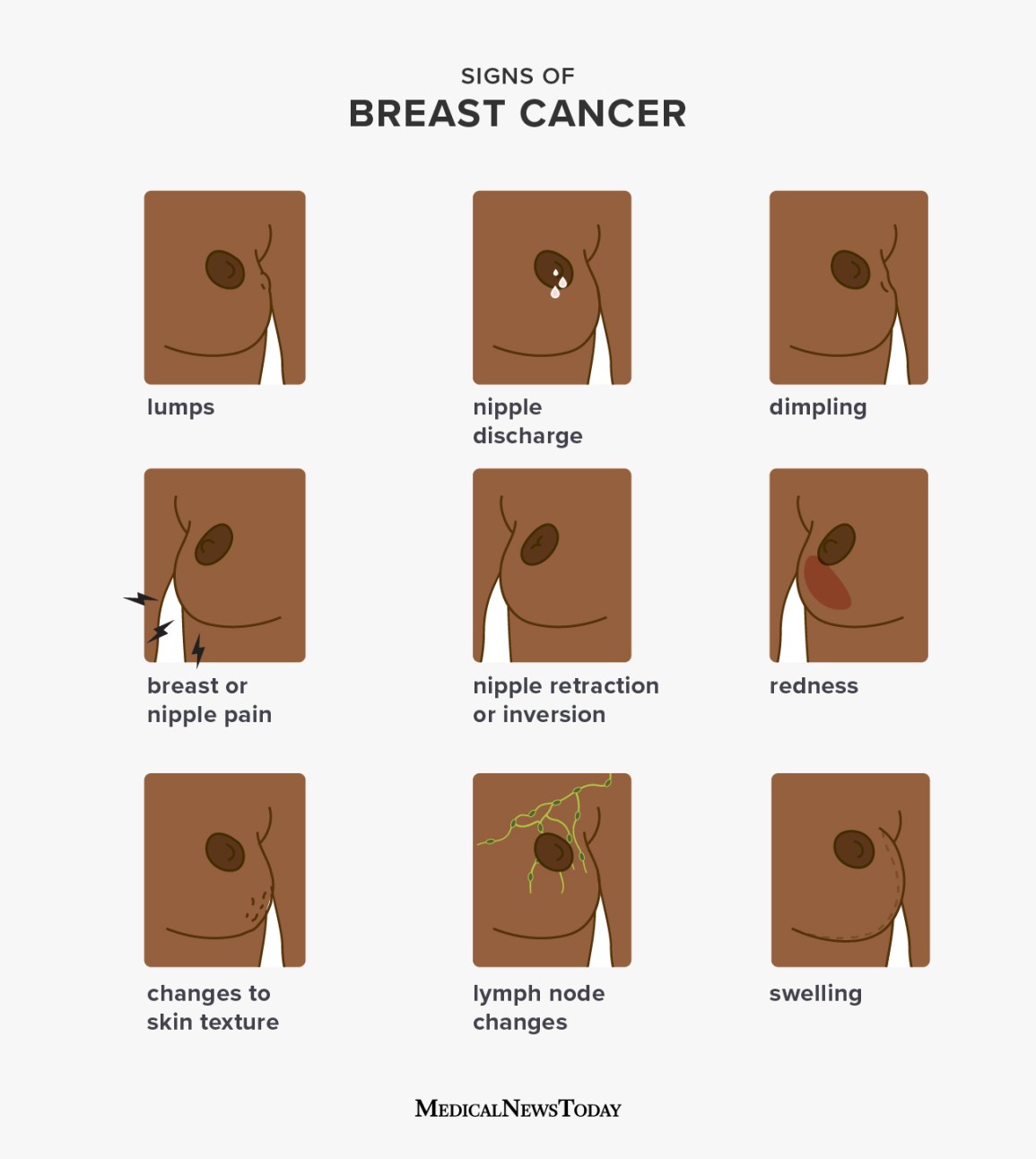 What can cause tumor in the breast?