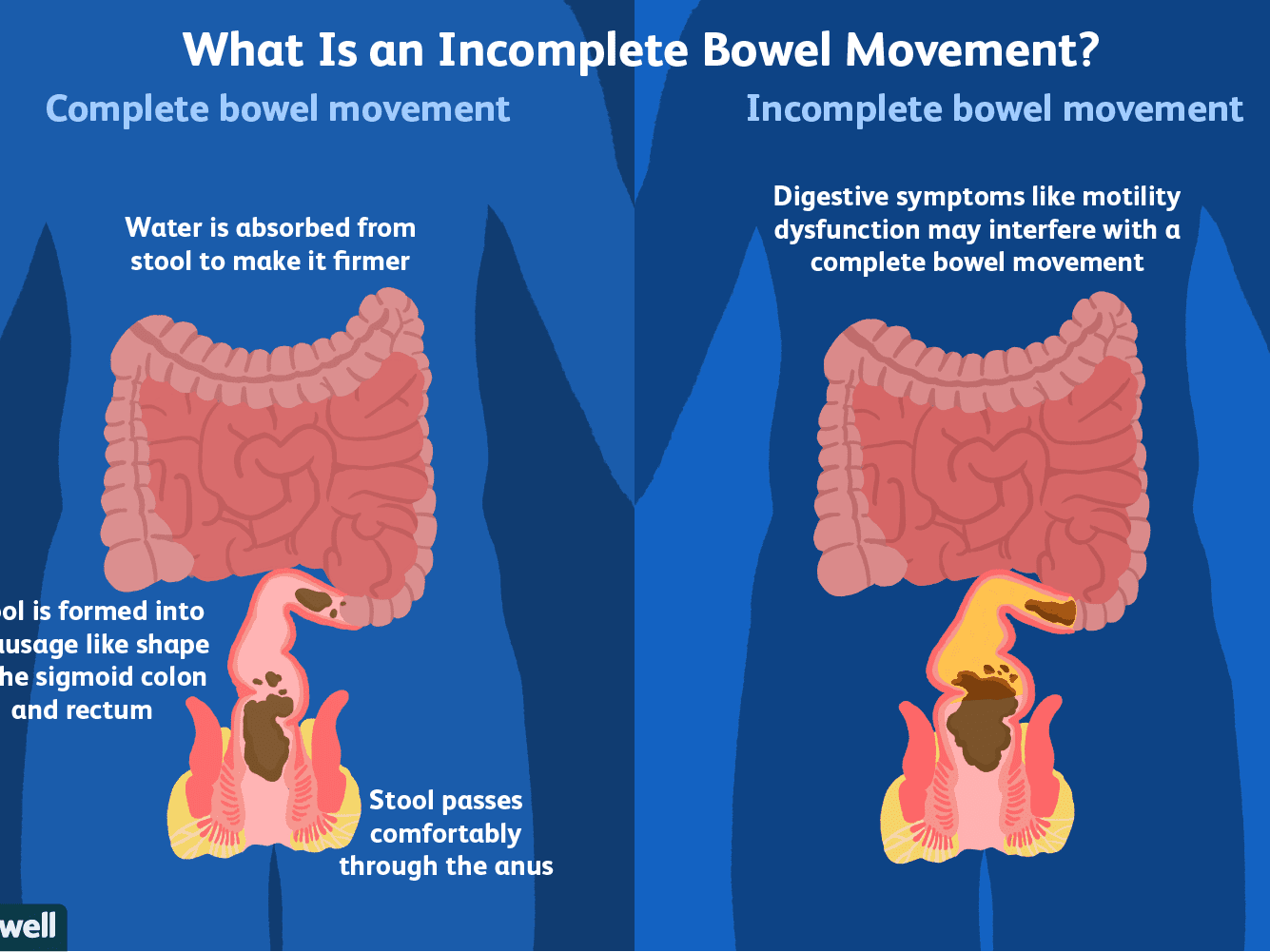 What can happen to your body if you don't poop?