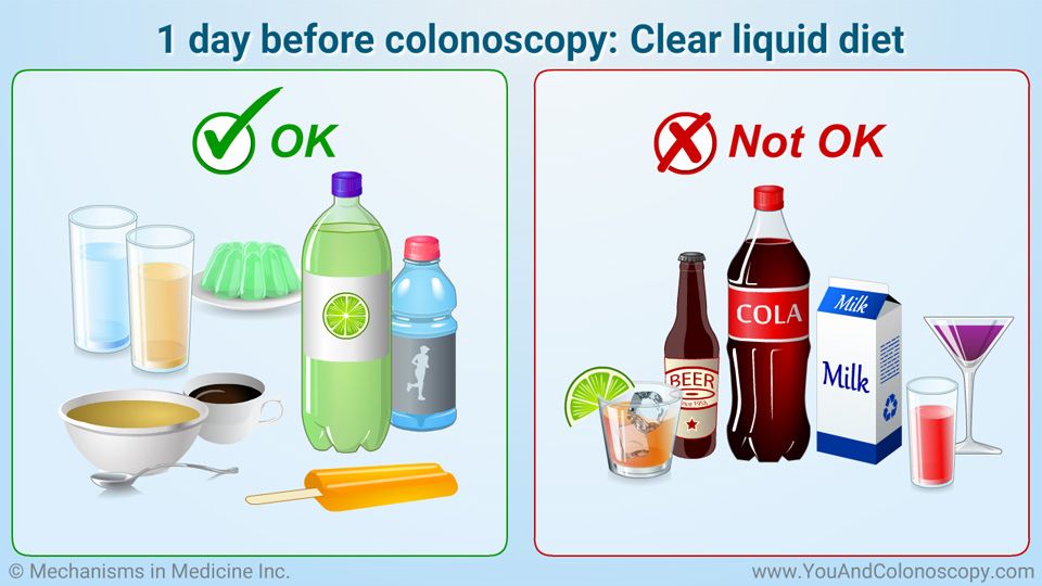 What can I drink the day before a colonoscopy?
