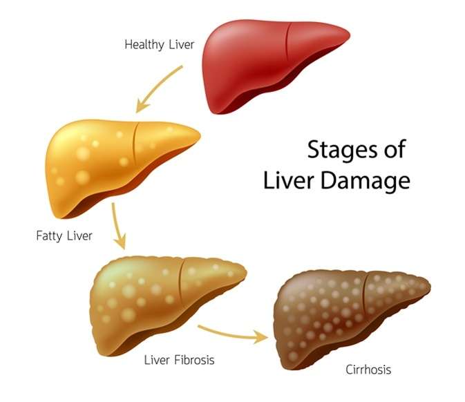 What can I drink to fix my liver?