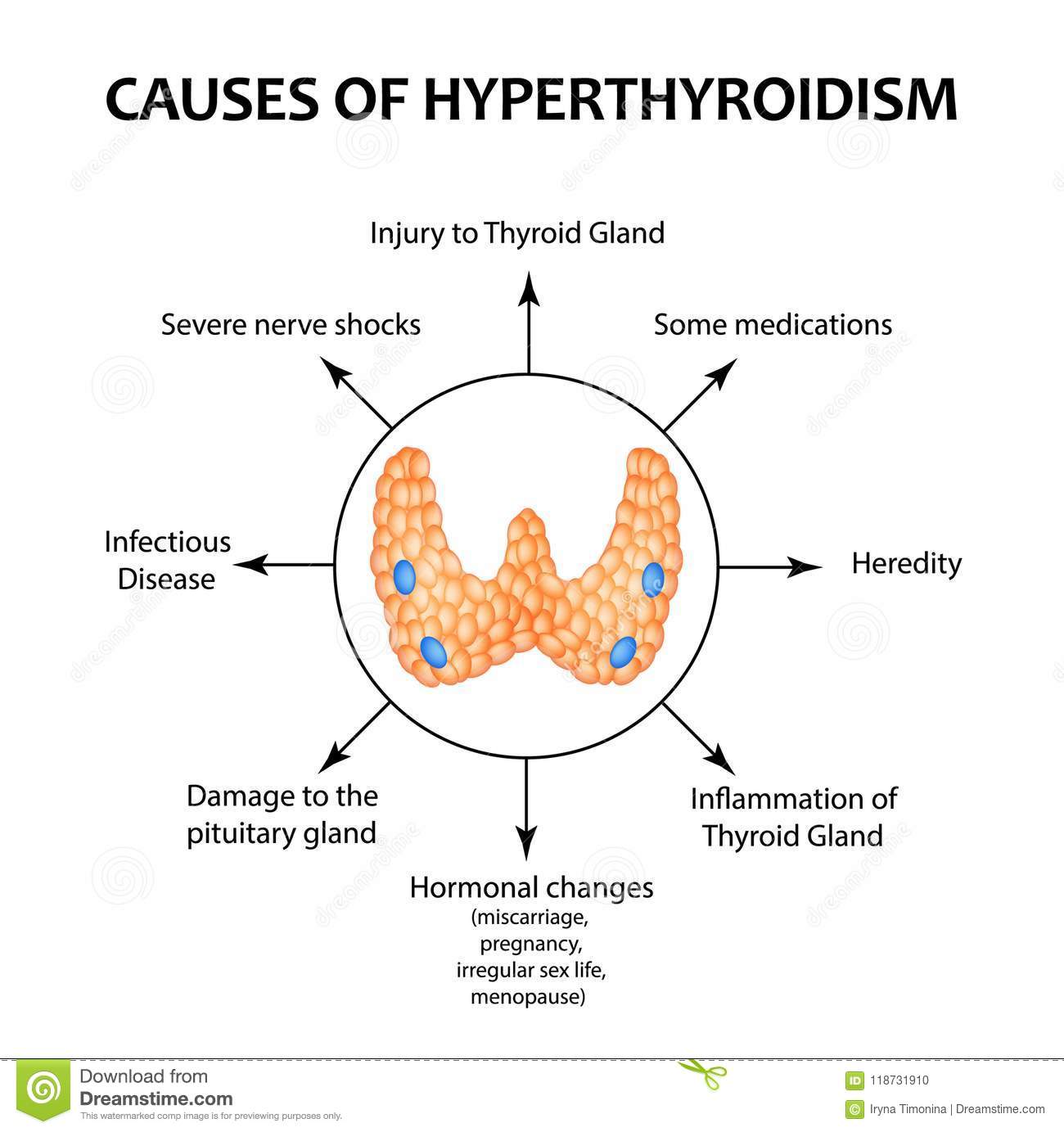 What can trigger hyperthyroidism?