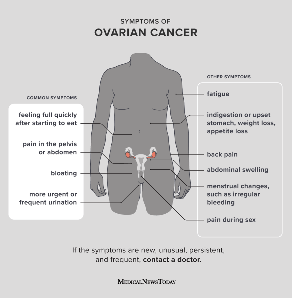 What cancers cause stomach bloating?