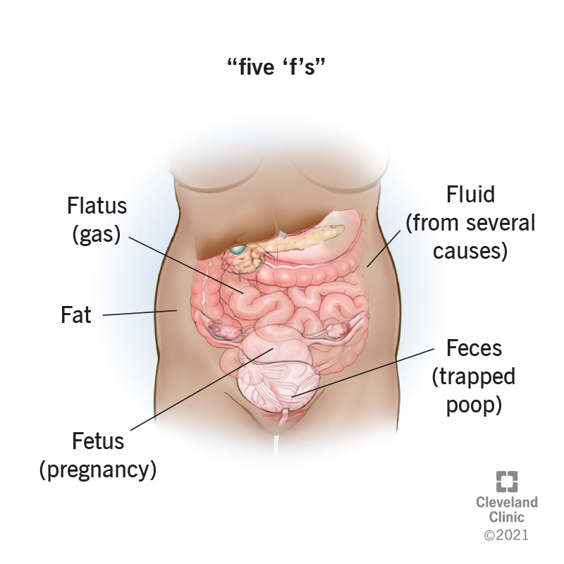 What causes a large bloated stomach?