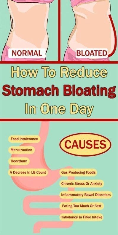 What causes bloating stomach?