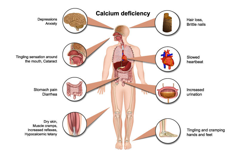 What causes calcium deficiency in the body?