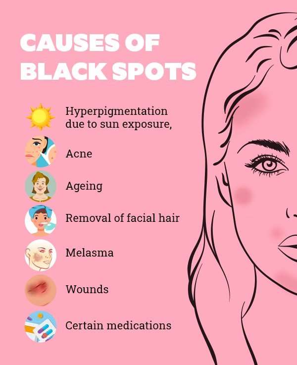 What causes dark spots to appear?