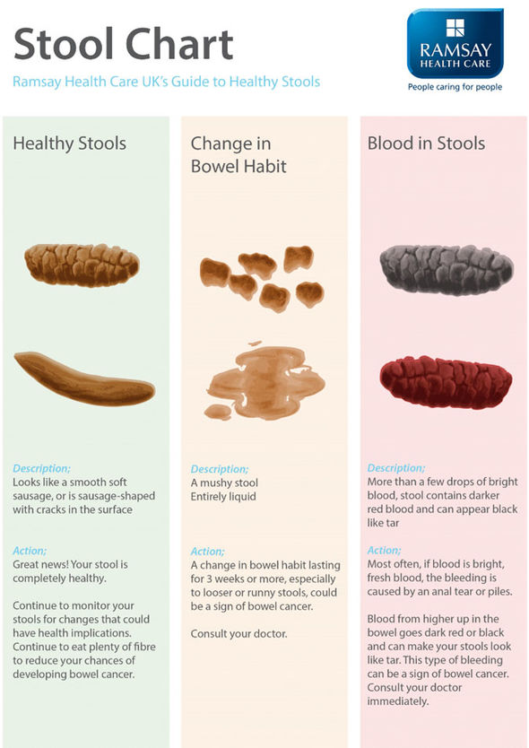 What Causes Fishy Smelling Bowel Movements 2022 QAQooking wiki