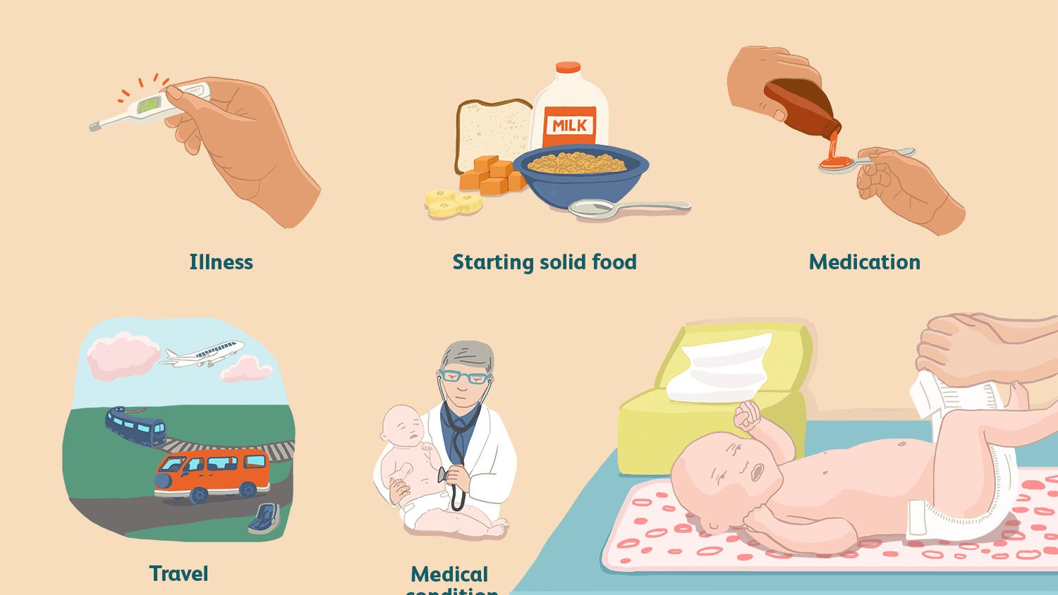 What causes foul-smelling stools in babies?