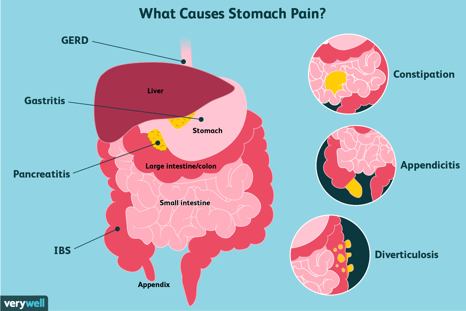 What causes hurt in stomach?