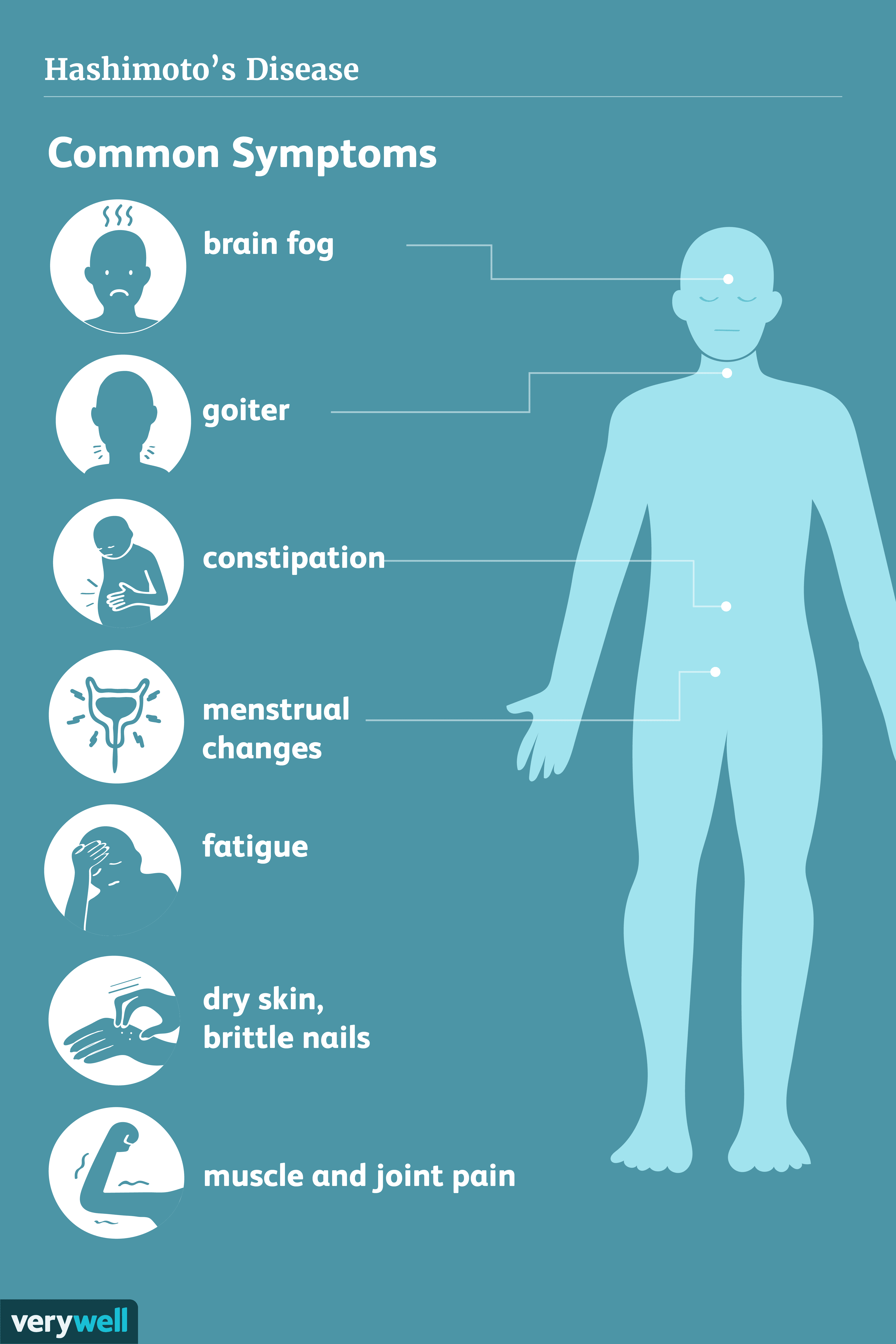 What causes inflammation with Hashimoto's?