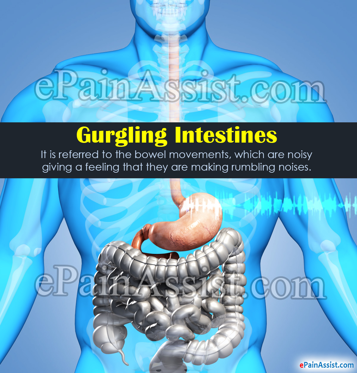 What causes loud intestinal gurgling?
