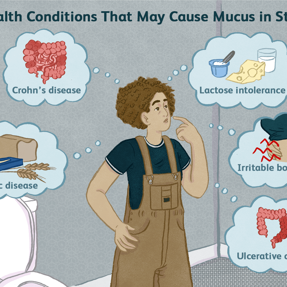 What color is mucus from IBS?