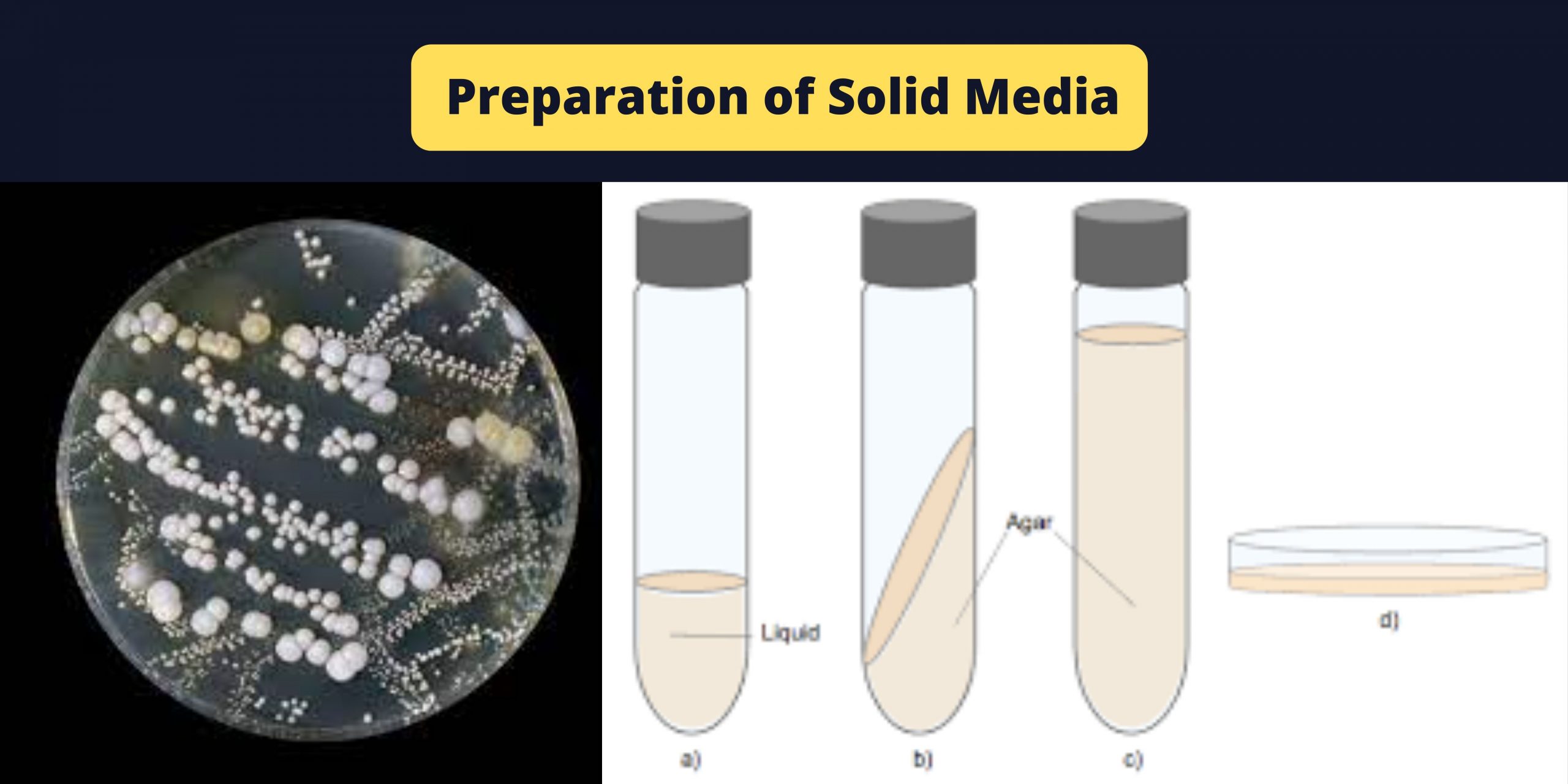 What do microbiologist add to liquid media to make it solid?