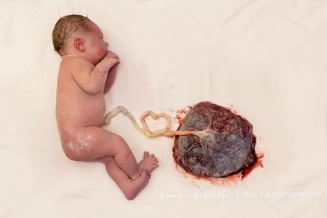 What do you do with placenta after birth?