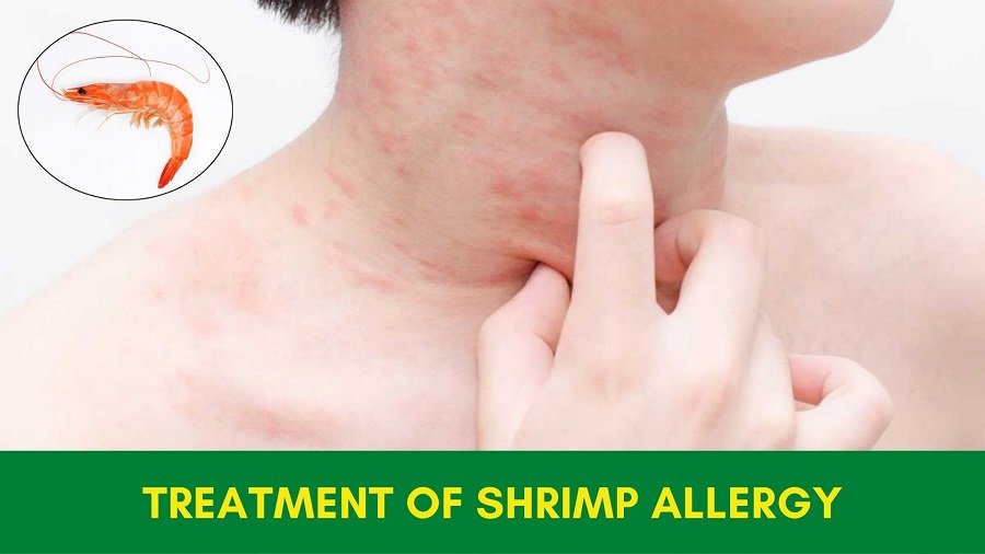 What does a shrimp allergy feel like?