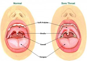 What does gargling salt water do for a sore throat?