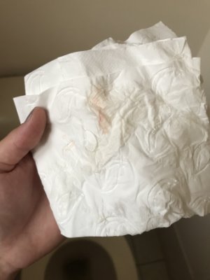 What does it mean when you wipe and there's a little bit of blood?