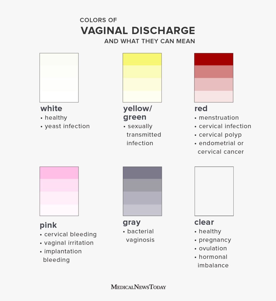 What does it mean when your discharge is thick and creamy?