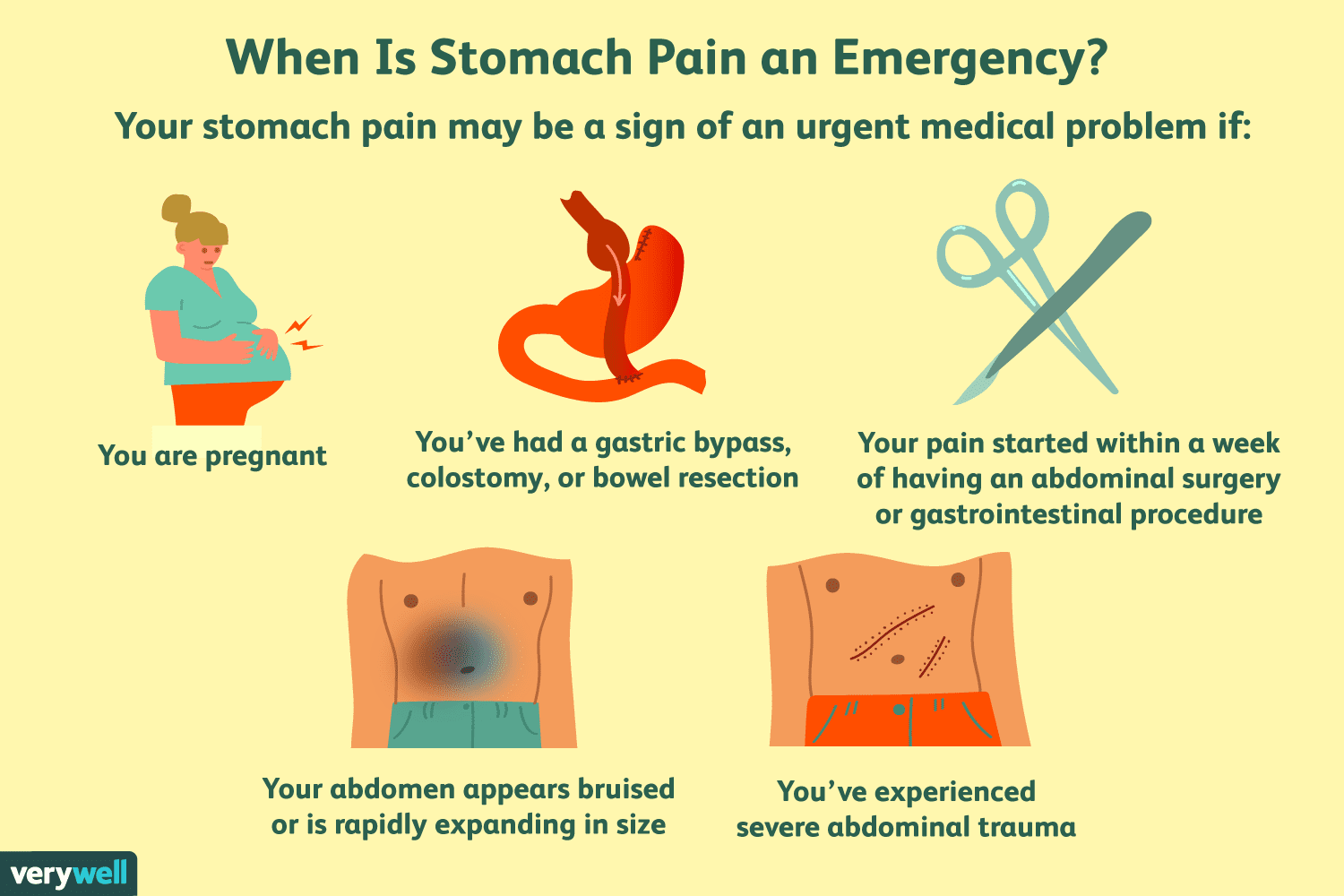 What does serious abdominal pain feel like?