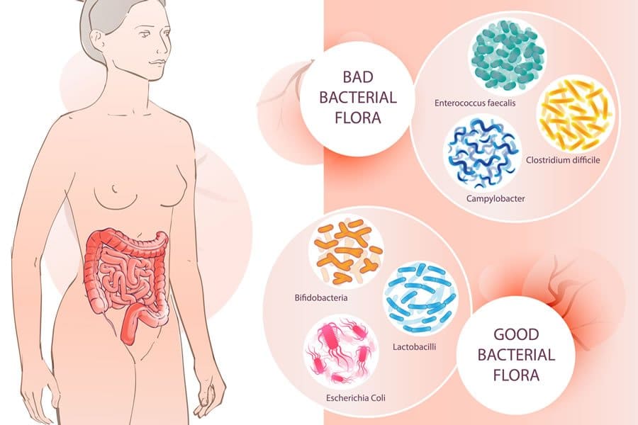 What does small intestinal bacterial overgrowth mean?