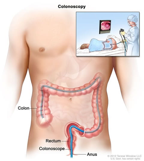 What happens if you are pregnant and have a colonoscopy?