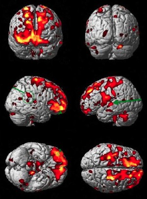 What happens if you eat fish brain?