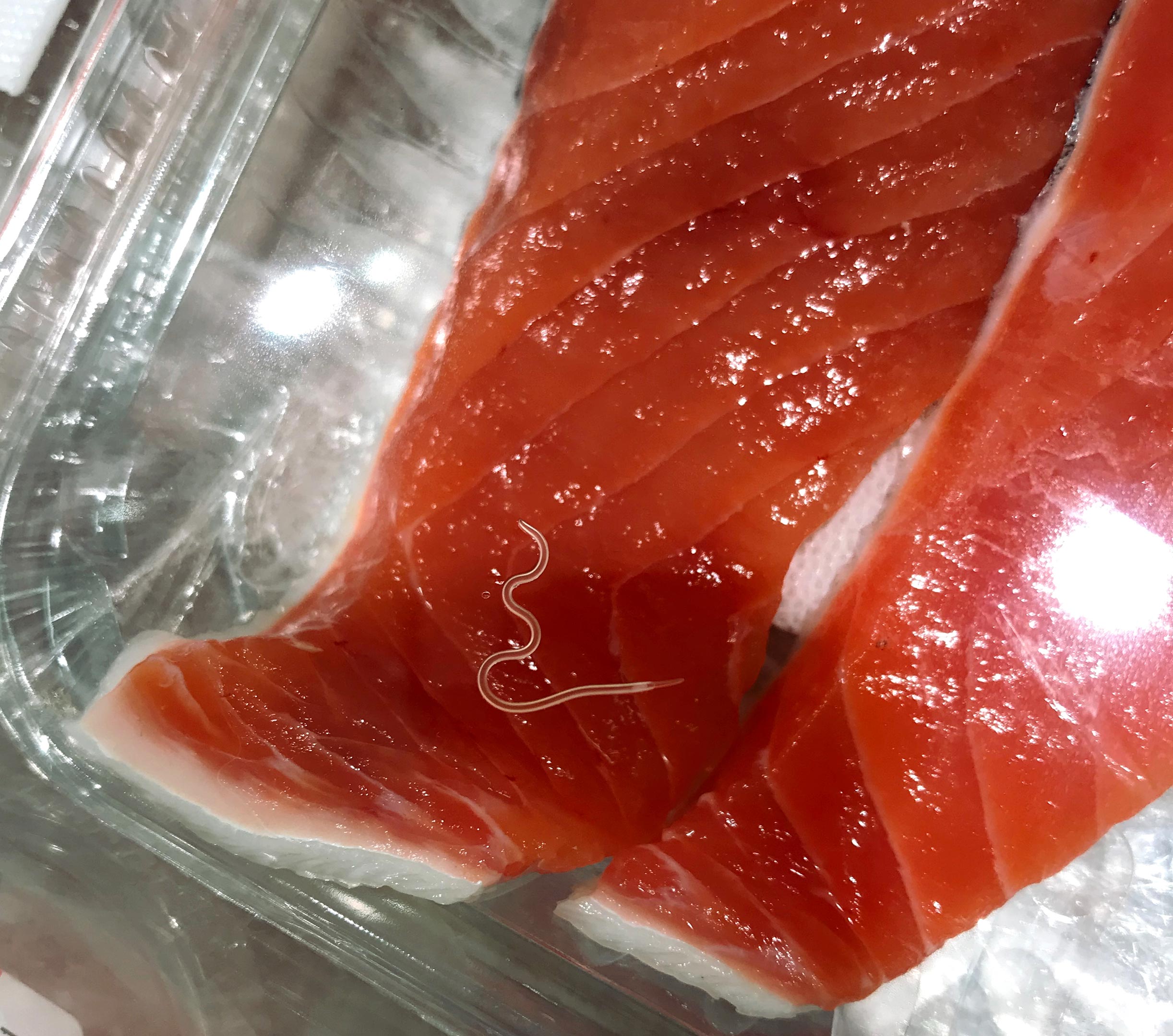 What happens if you eat raw salmon with worms?