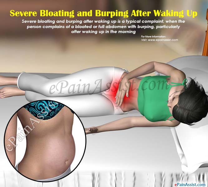 What is burping bloating?