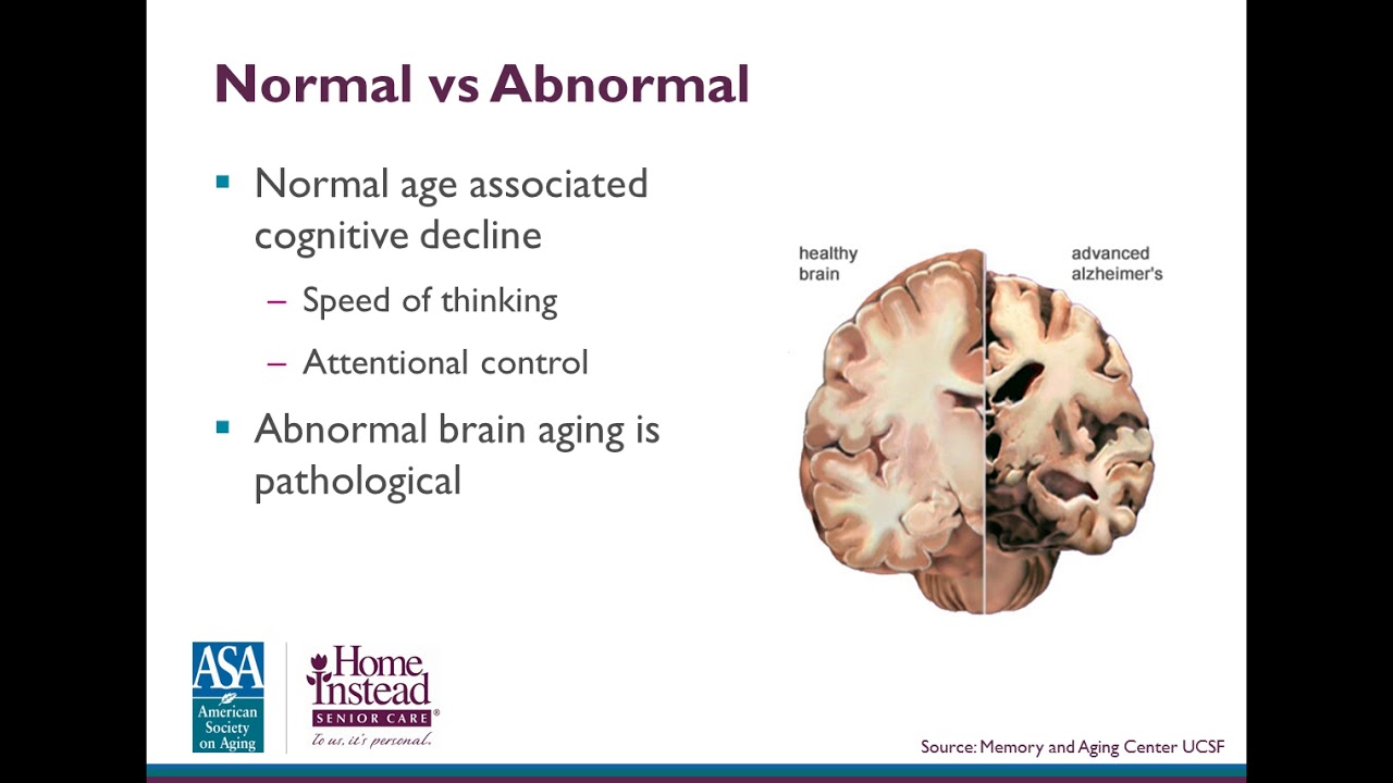 What is good for an aging brain?