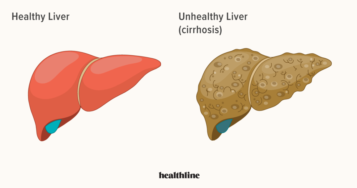 What is most damaging to the liver?