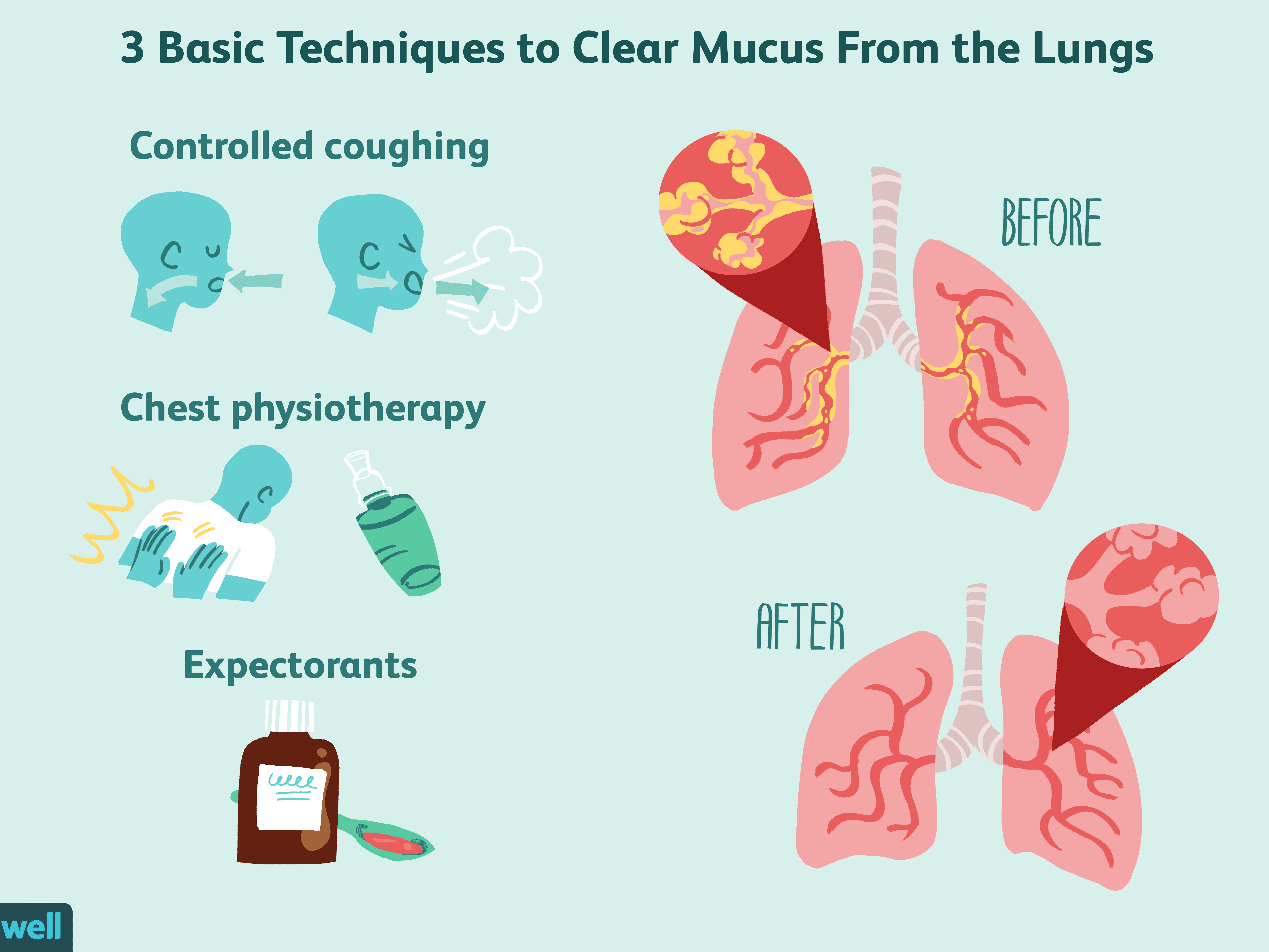 what-is-the-fastest-way-to-drain-mucus-from-lungs-2022-qaqooking-wiki