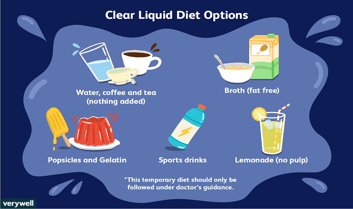 What is the next diet after full liquid?