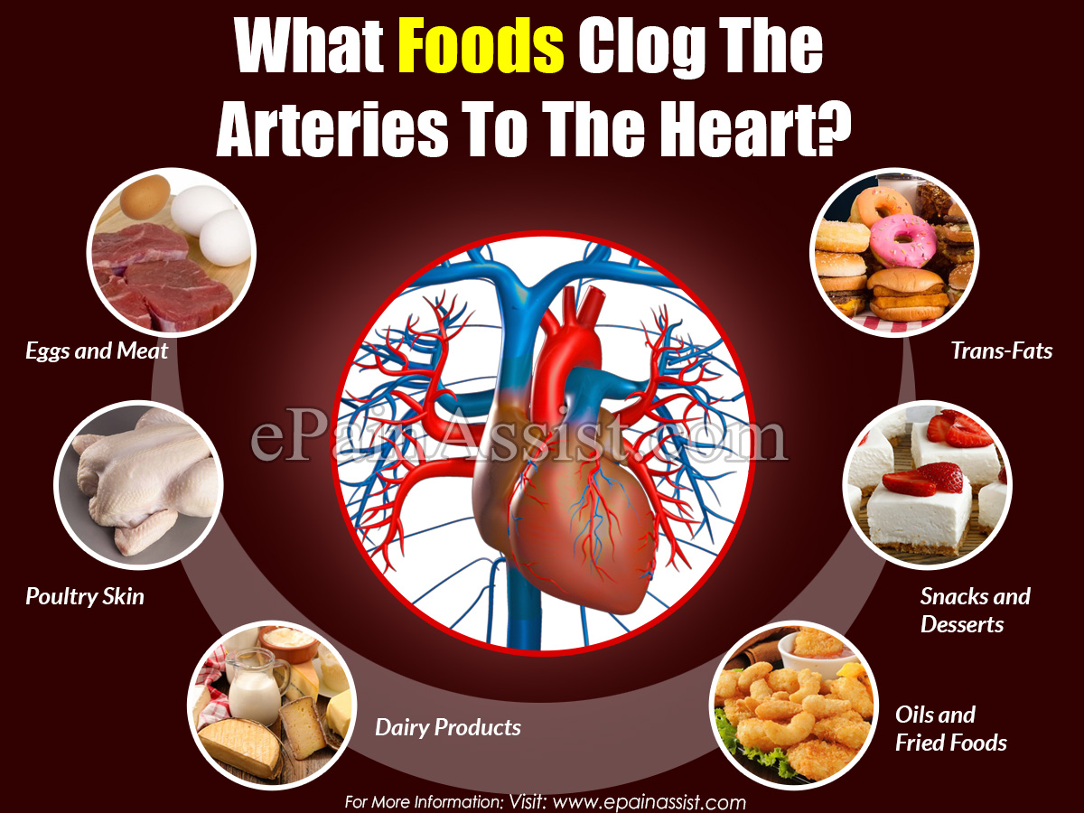 What kind of food clogs your arteries?